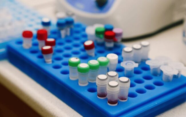 Genetic Testing for Autism: What to Know