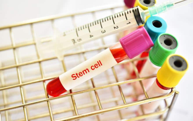 Understanding Autism Stem Cell Treatment